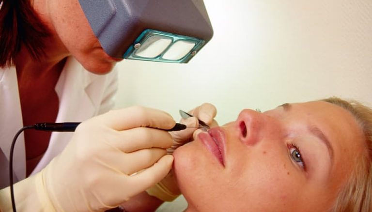 Electrolysis - Body and Face Options - Aesthetic Clinic